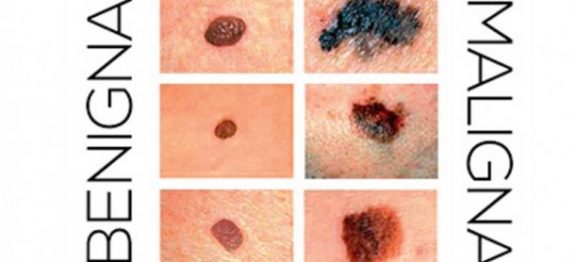 Tudo o que devemos saber sobre as pintas - Veja a Receita: