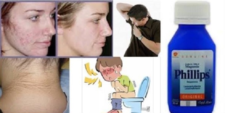 10 USOS INCRÍVEIS DO LEITE DE MAGNÉSIA QUE VÃO SURPREENDER VOCÊ! - Veja ...