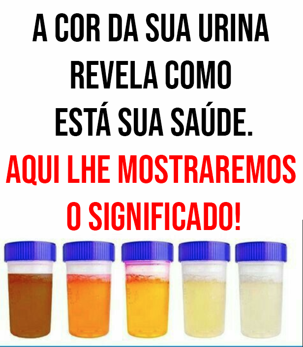 A cor da sua urina revela como está sua saúde. Aqui lhe mostraremos o ...