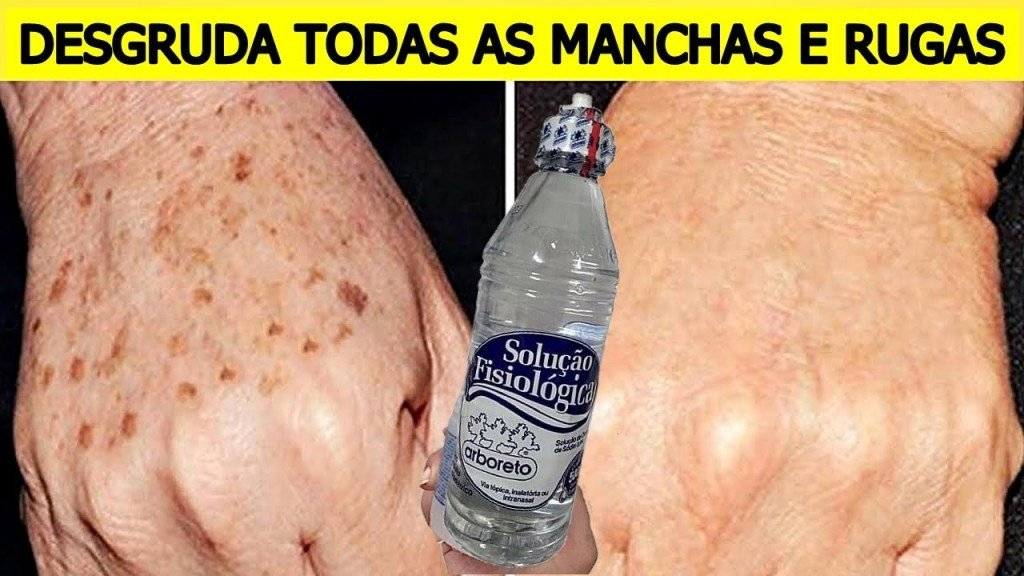 PINGA NA MÃO MURCHA E MACHADA, AS RUGAS VÃO DERRETER IGUAL GELO/ PINGOU ...